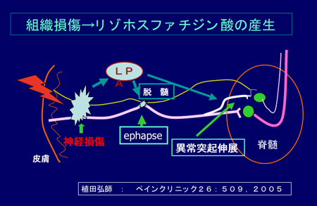 第21回 日本疼痛漢方研究会-1 - 漢方スクエア
